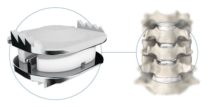 Long Island Neurosurgeon | Neurosurgery on Long Island, NY